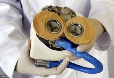 The first artificial heart was implanted into a man named Dr. Barney ...