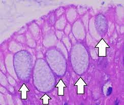 Real life goblet cells!