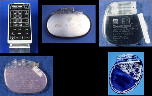 During the 1990s microprocessor pacemakers were developed and were ...