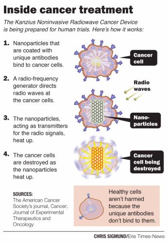 The infographic explains how thetreatment works.