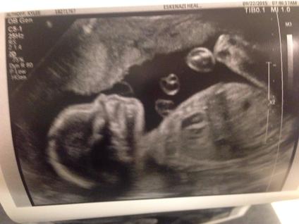 When I found out I was pregnant, was the biggest event of my life. My ...