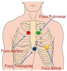 Los 4 focos auscultatorios: Aórtico, Pulmonar, Tricuspídeo y Mitral.
