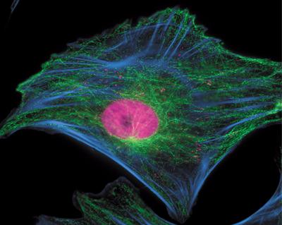 The cytoskeleton in a cell.