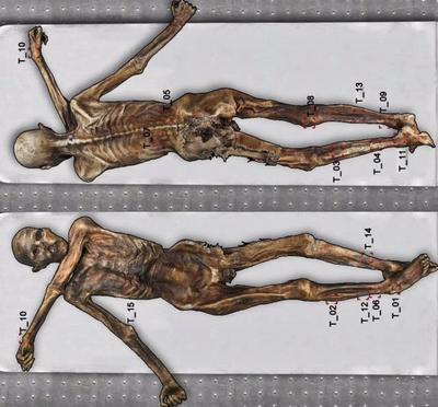 !Otzi' the amazing ice man! | Sutori