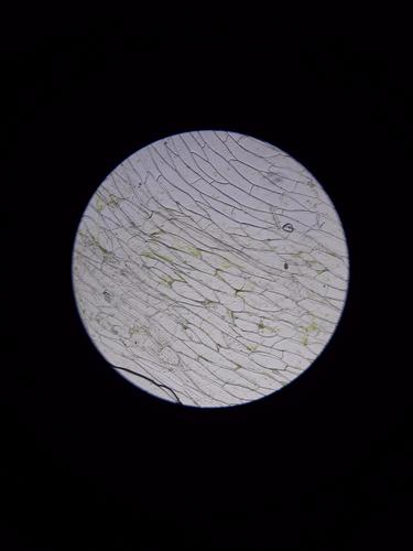 Esta es una foto tomada por un celular con el zoom del microscopio