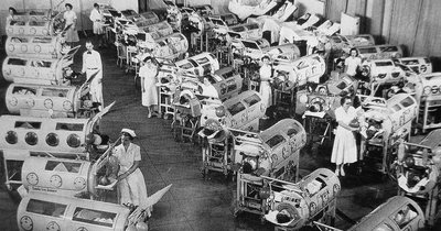 Polio