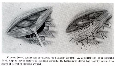 Civil War Anesthesia Inhaler
