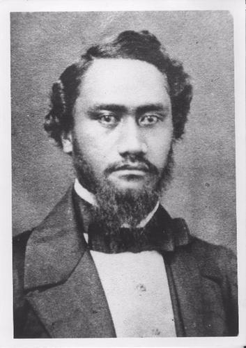 King Kamehameha IV(1856-1863)