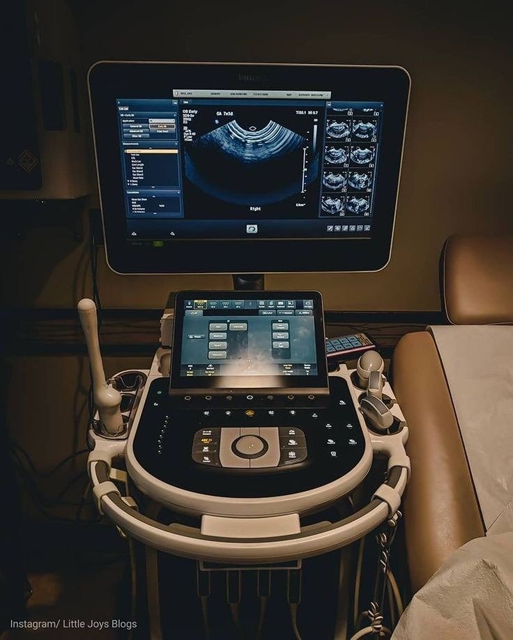 Ultrasound Apparatus