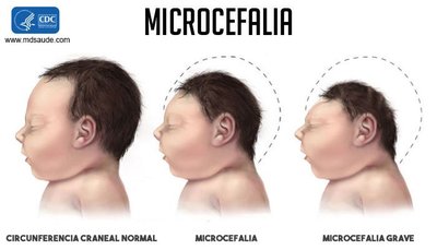 Etapa de Proliferación neuronal: