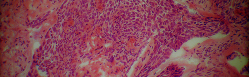 Skin Cancer Dangers and Research by: Jack Seagle & Colby Freeman