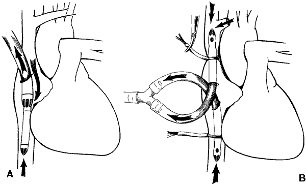 9:30 am Clamp and divide the AV loop