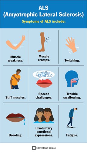 Symptoms of ALS