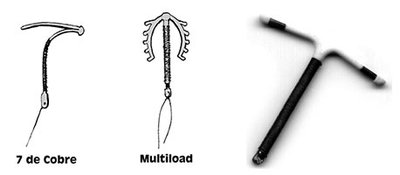 En 1959 creó el primer dispositivo intrauterino ( DIU ) hecho en Chile.