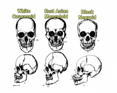 US anthropologists name three races: Caucasoid, Mongoloid and Negroid
