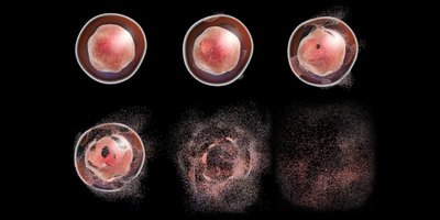Apoptosis: muerte celular programada