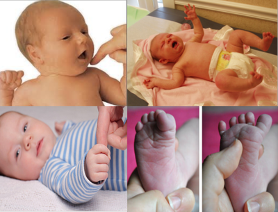 Motor Development during Infancy