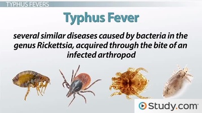 Typhus