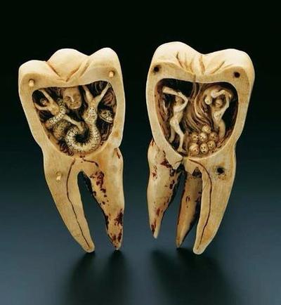 5000 BC Sumerian text describes that tooth worms were the cause of ...