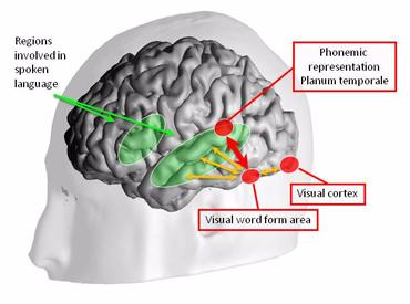 The picture above shows the location of the visual word form area ...