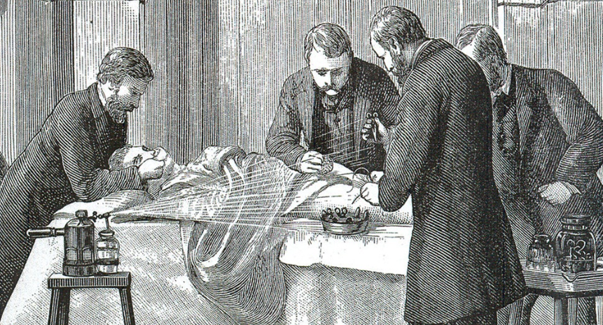 Lister spraying phenol over the wound while the doctors perform an ...