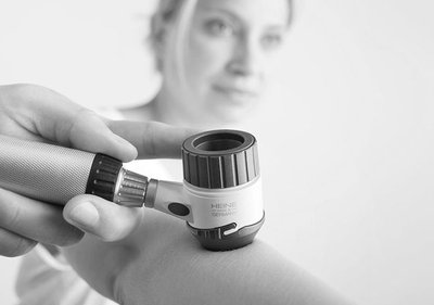 Dermatoscoop : om structuren in de huid zichtbaar te maken die met het ...