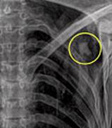 This could be the arrow tip.