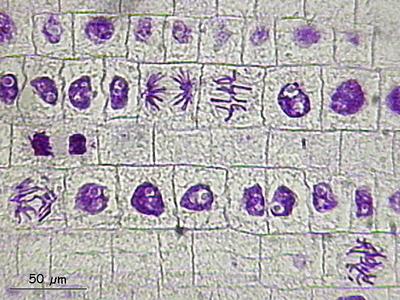 Extrémité de racine d'ail au microscope (X400)